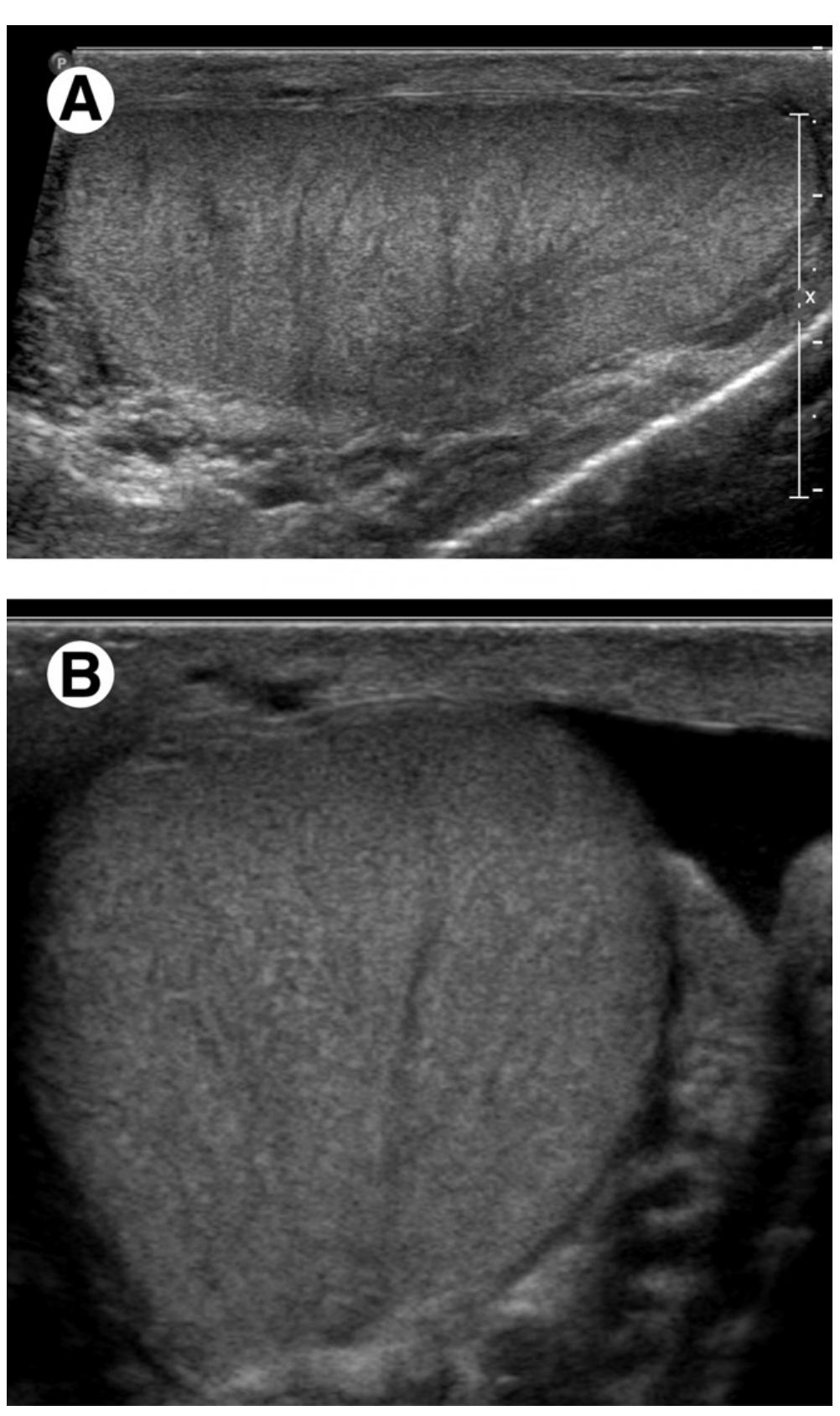 Normal striated testis. (a) longitudinal and (b) transverse