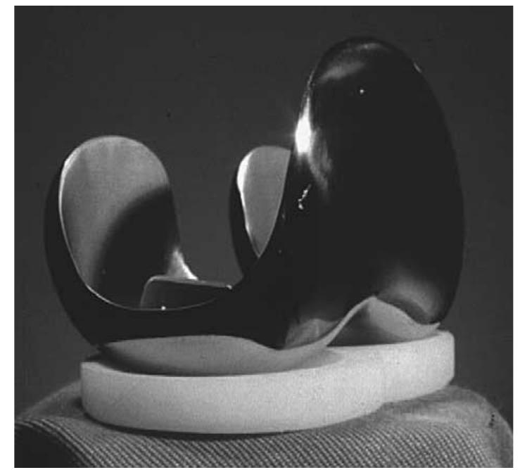 The kodama-yamamoto mark i knee (courtesy of sumiki