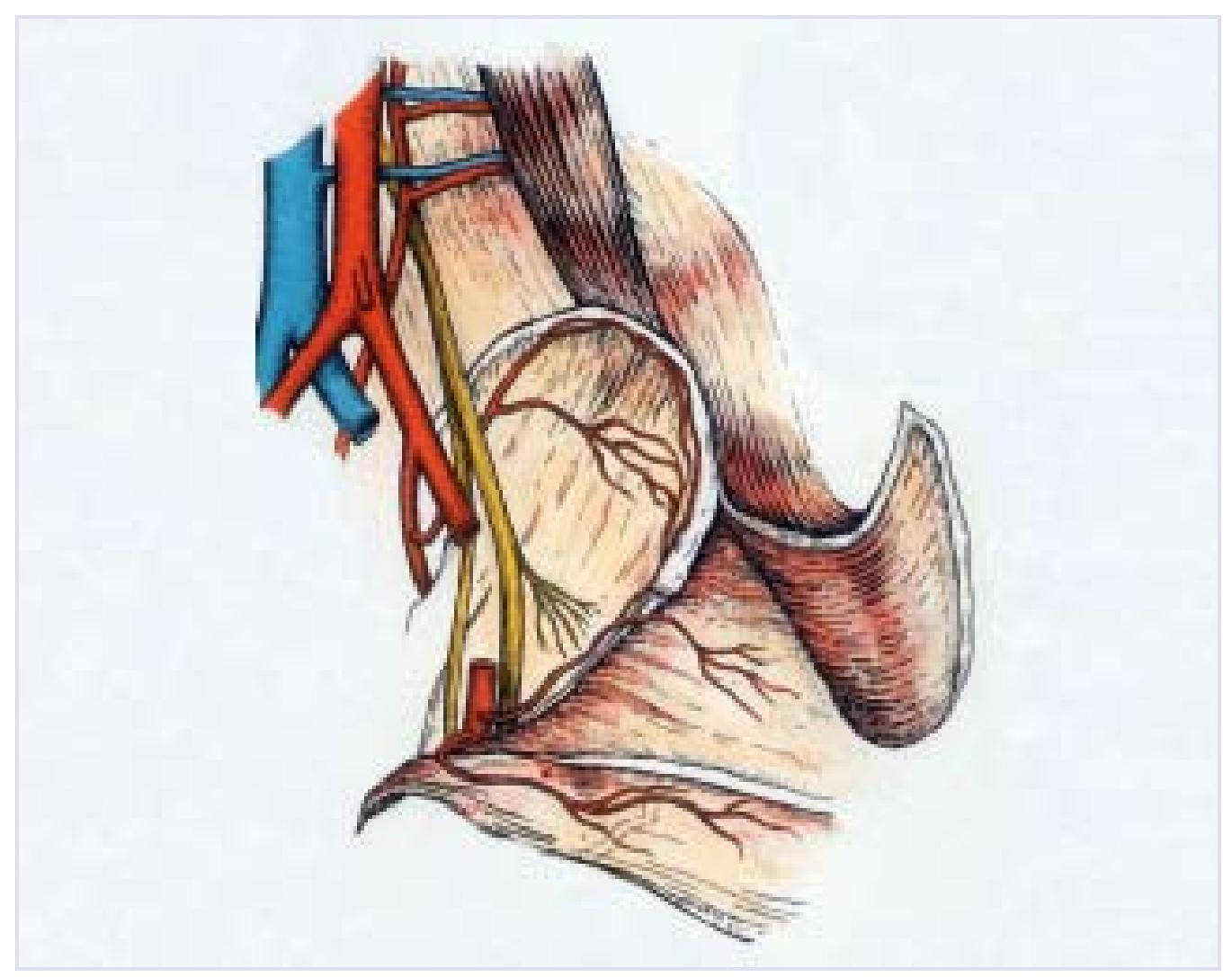 Figure 18 - Vascularized bone of the fibula and iliac crest