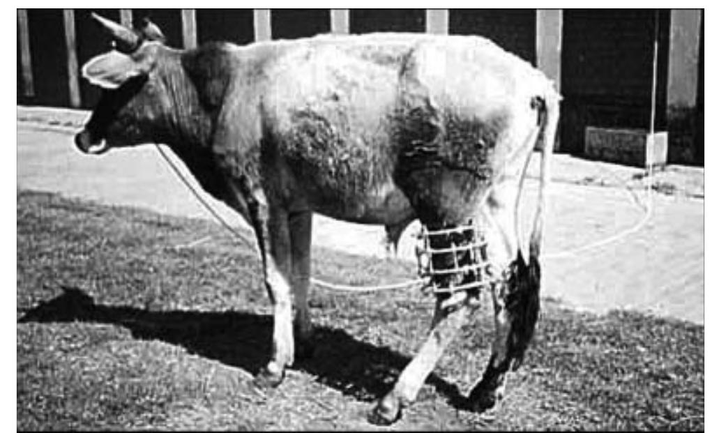 Fixation of tibial osteotomy using circular fixator in a