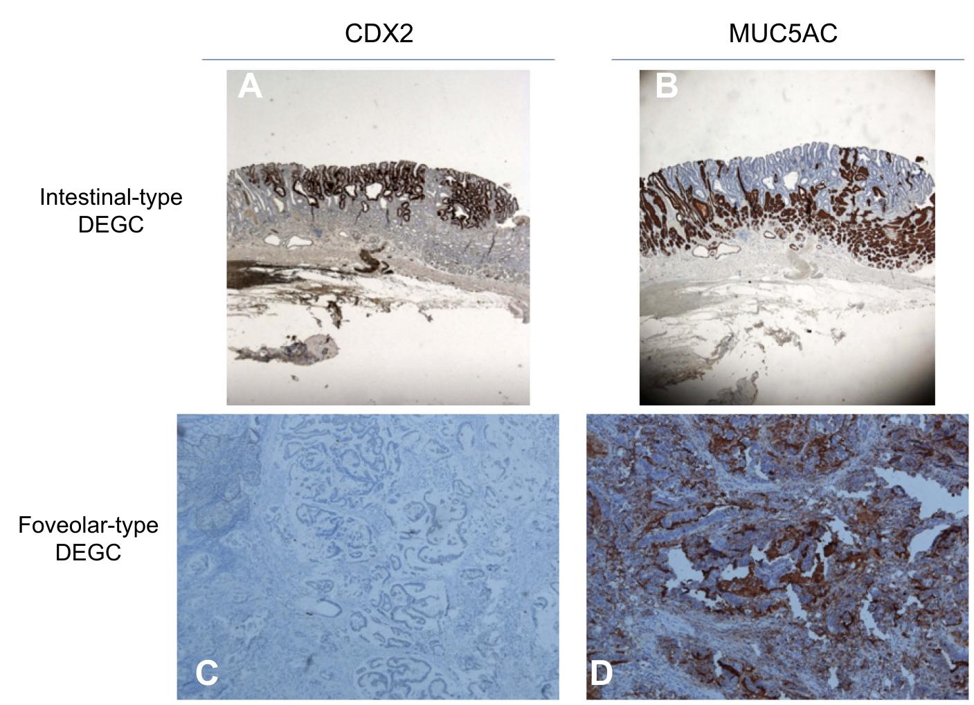 | ihc patterns in type of differentiated egcs (a and b)