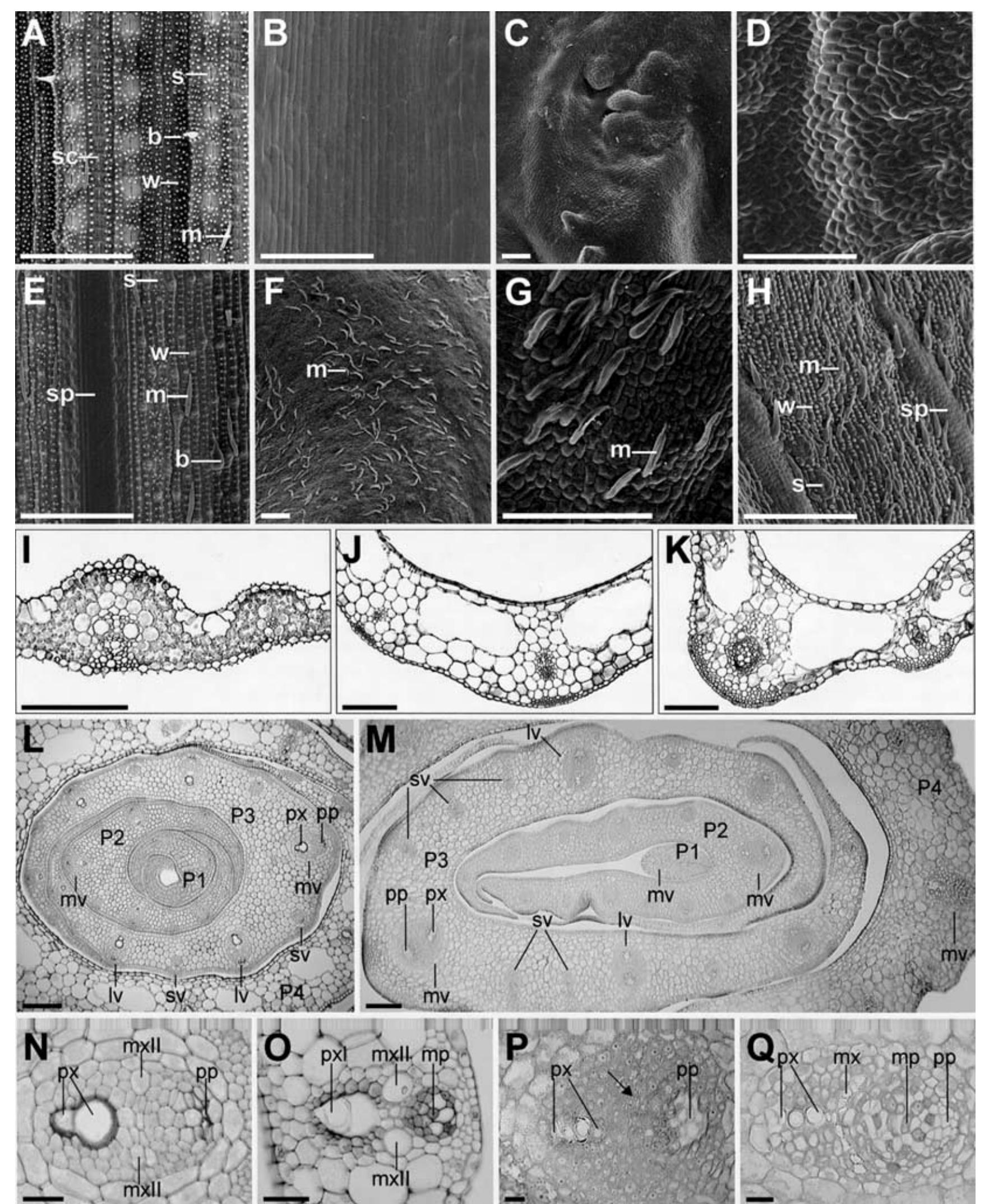 Epidermal cell types and leaf anatomy of wild type,