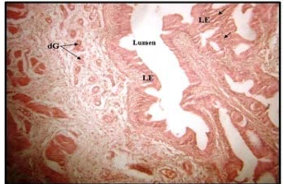 Plate_5: uterus section photomicrograph from positive