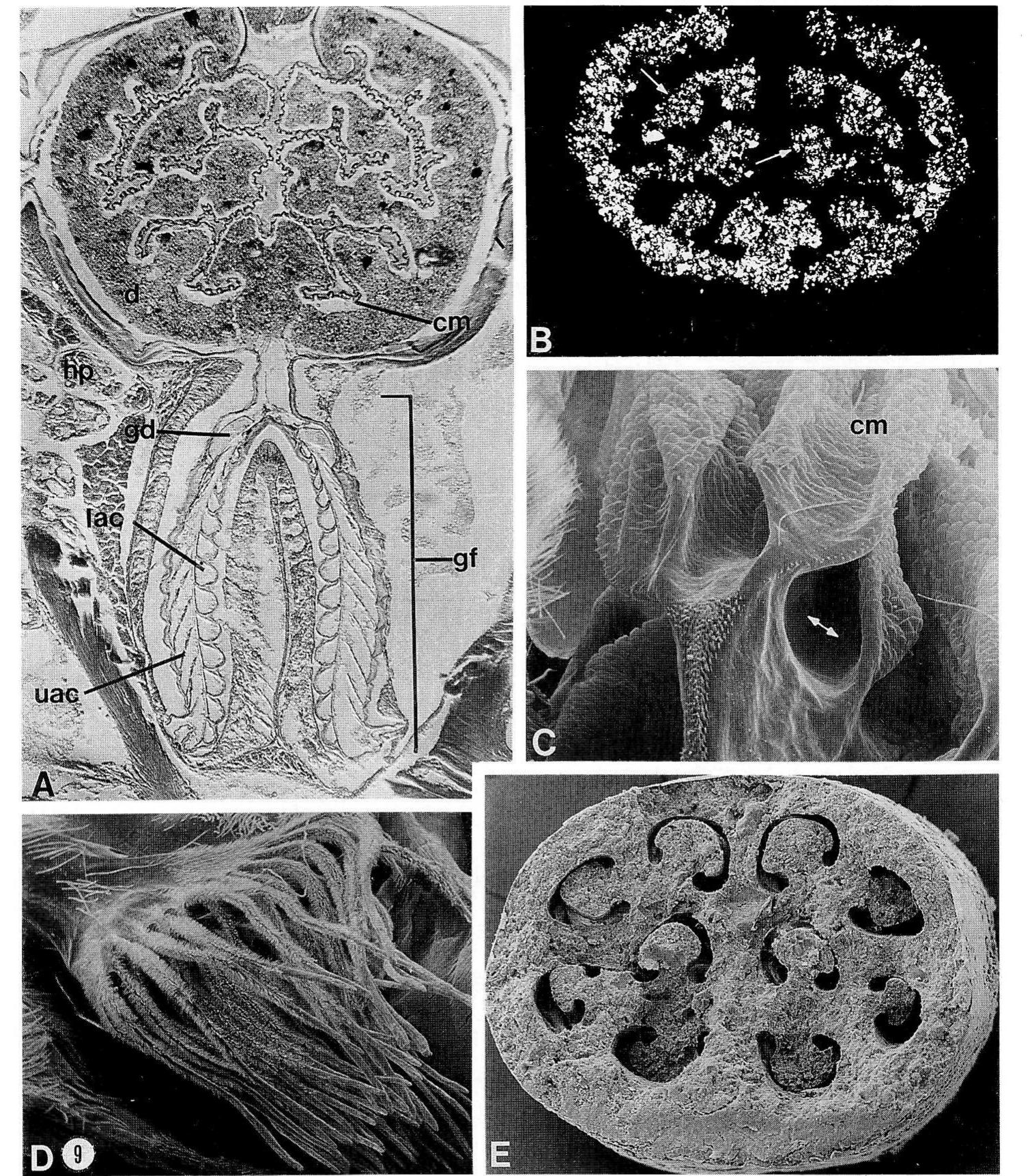 Shown in a. sem. x 1,200. d: external view of pyloric