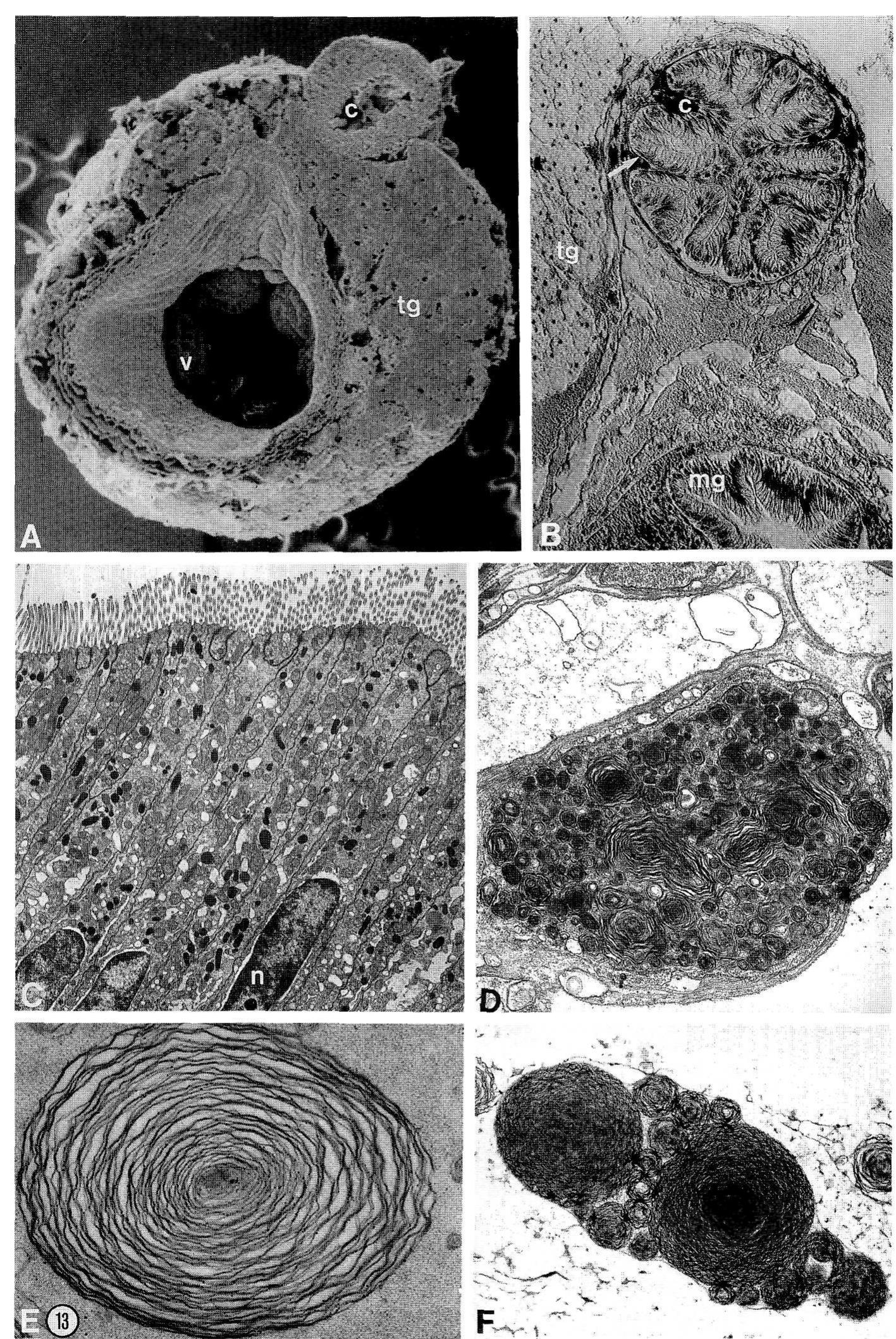 Brane of the pmgc. x600. c: ultrastructure of columnar cells
