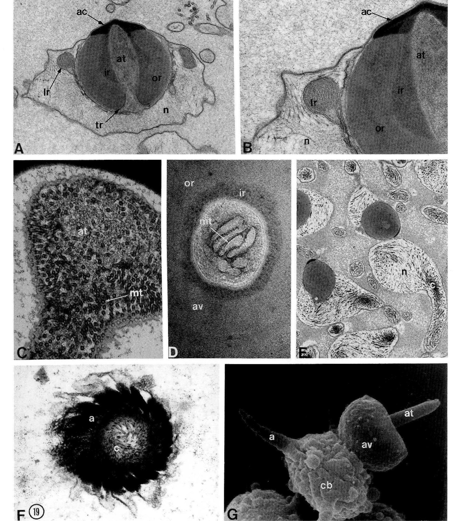 Cantha sp. x9,000. f: cross-section through the arms of the