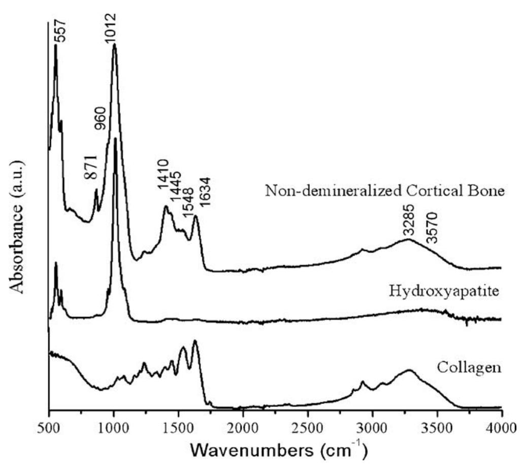- comparison of the ftir spectra of non-demineralized