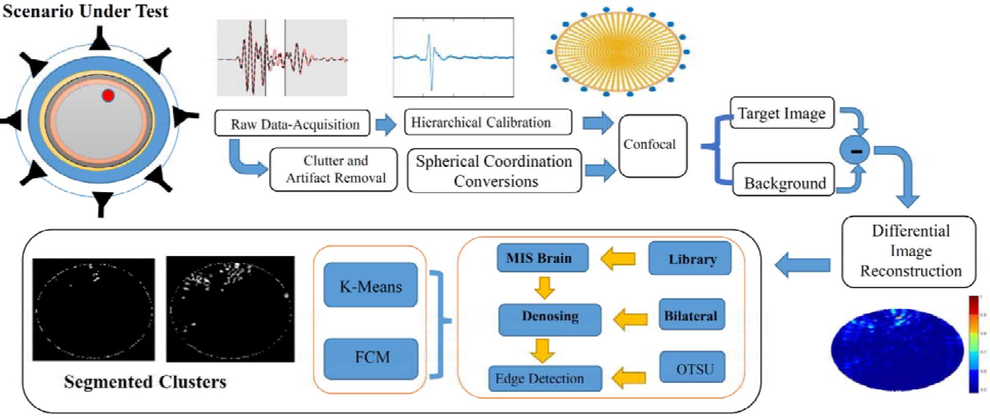 Proposed algorithm flowchart for stroke detection,