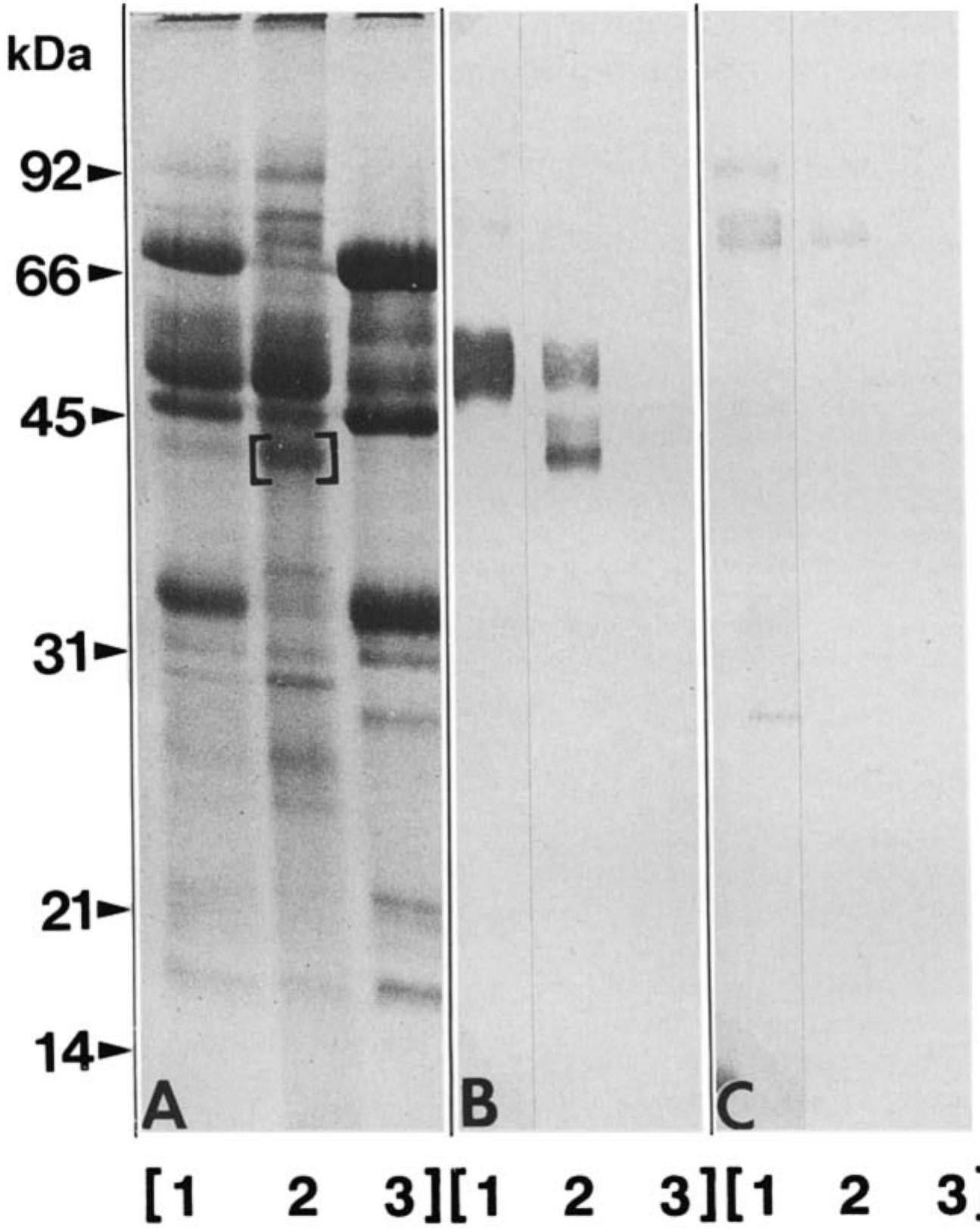 Apical segment fractions were subjected to reducing sds-page