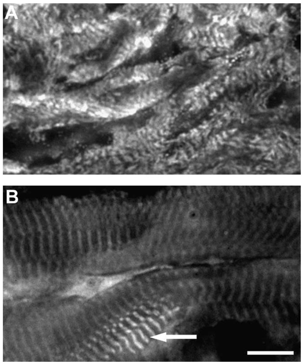 Immunofluorescence staining of neonatal and adult ventricle.