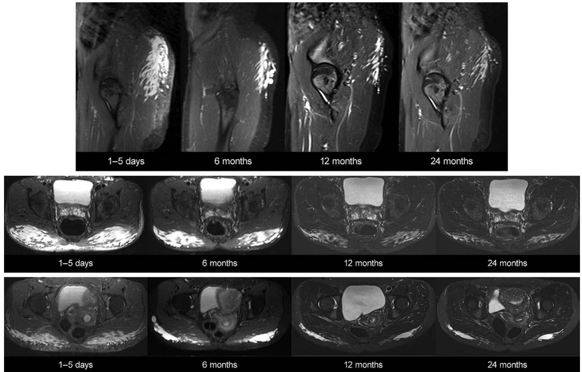 Magnetic resonance imaging scans of nonanimal stabilized