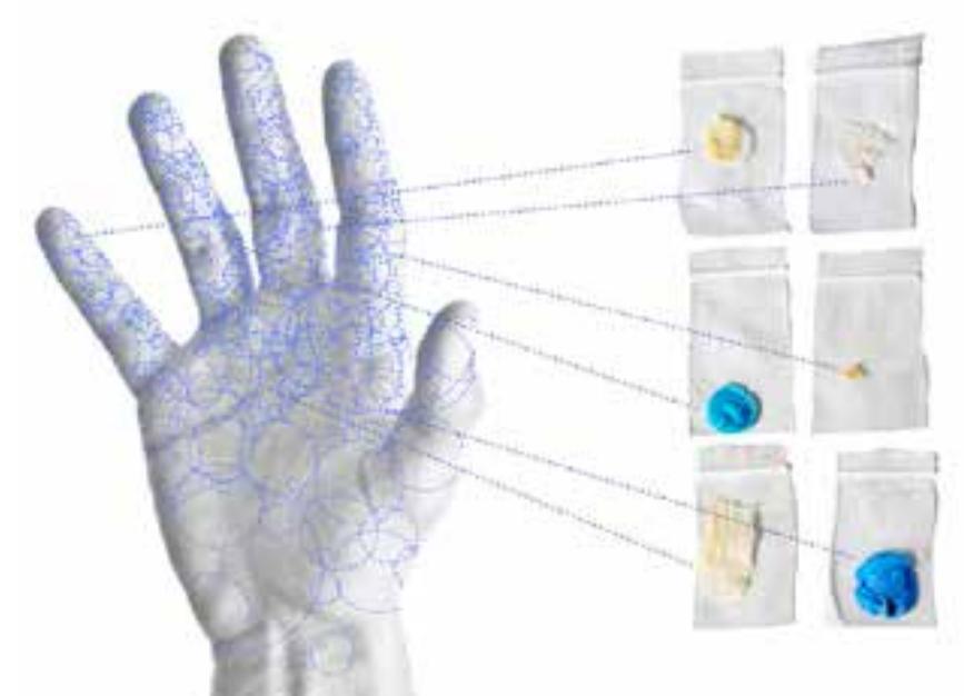 Diagram representing the cast sites in 100 hand sites, and a
