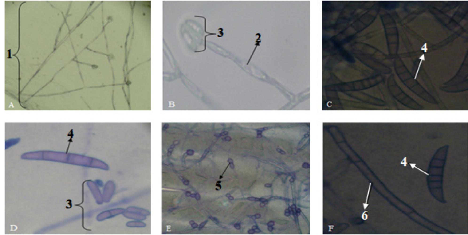 Microscopic morphology of fusarium solani isolates (400x