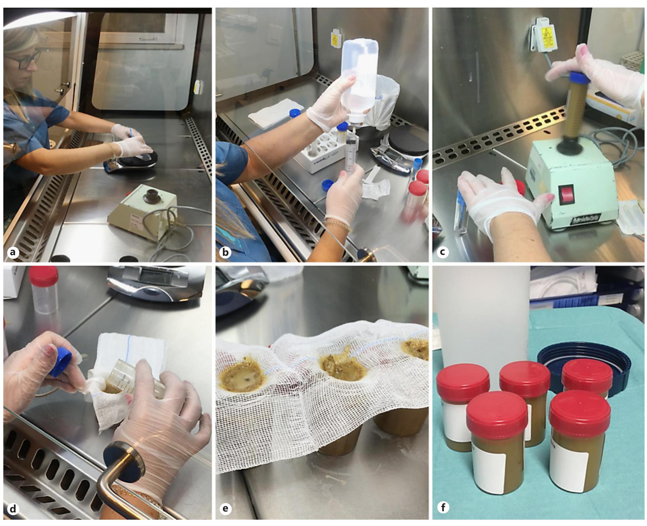 Stages of fecal material processing in a level 2 biosafety