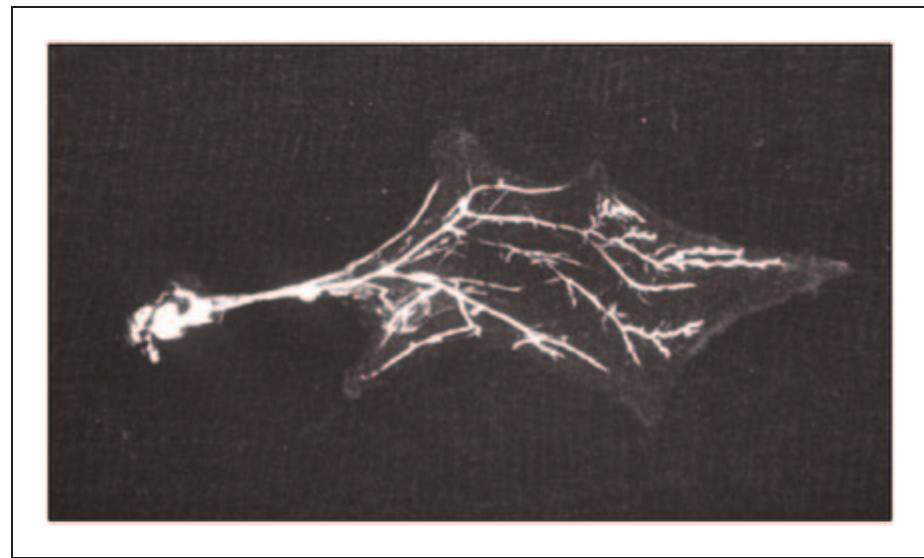 Microangiographic view of the vascular structure of the