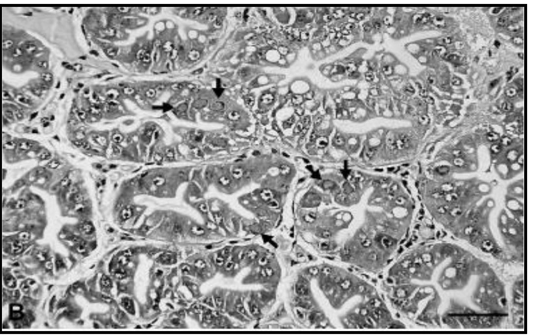 2.6 the nuclei of epithelial cells were hypertrophied with