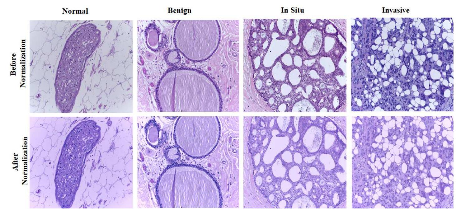 Examples of histology images from each class before (top