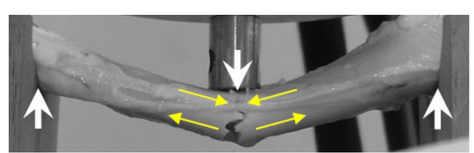 (a, b): anterior and posterior views of sheep tibia, (c):