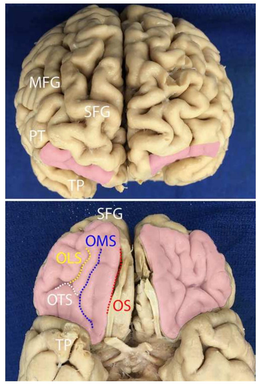 Superficial anatomy of the orbitofrontal cortex (ofc).