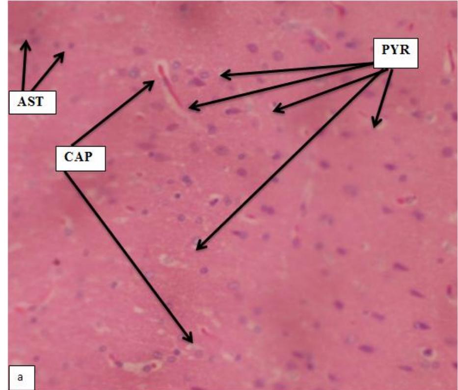 -6a: figure 7: photomicrograph of h and e stain of the