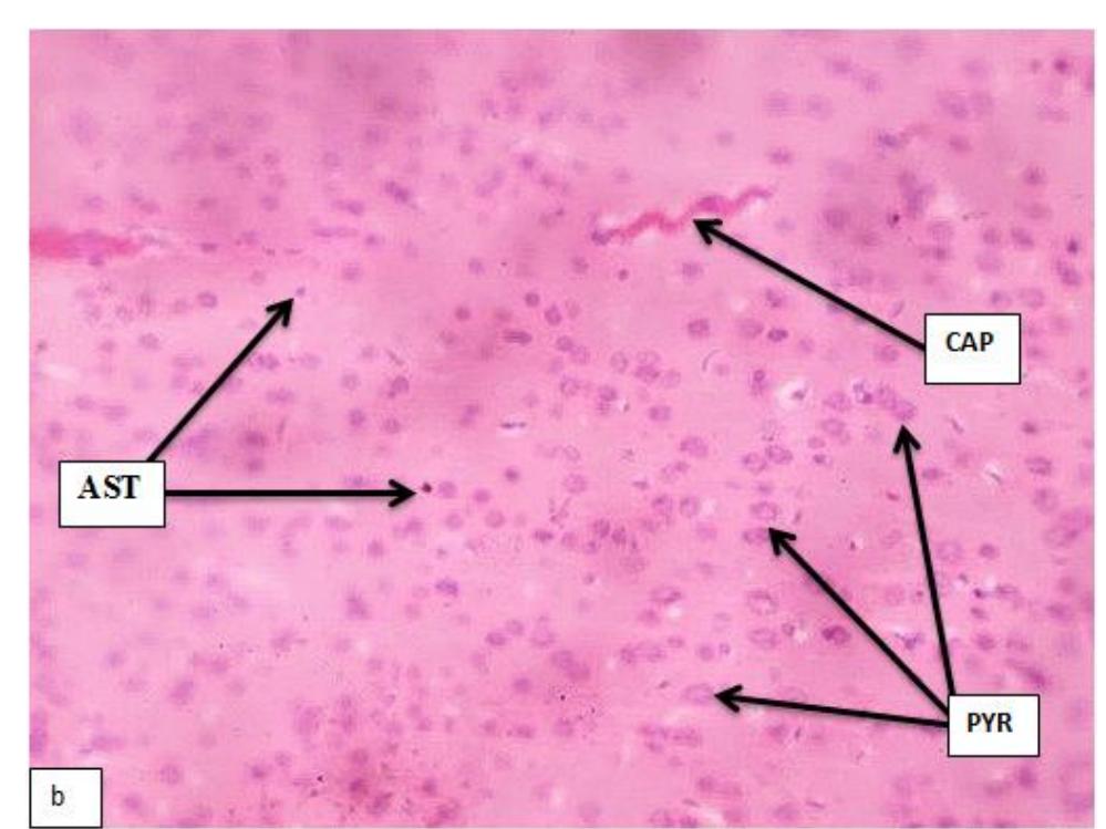 -6b: figure 5: figure 7: photomicrograph of h and e stain of