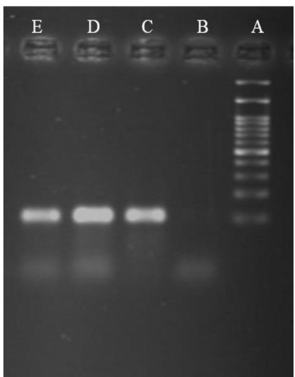 Thermal resistance of different states of e. coli o157:h7 at