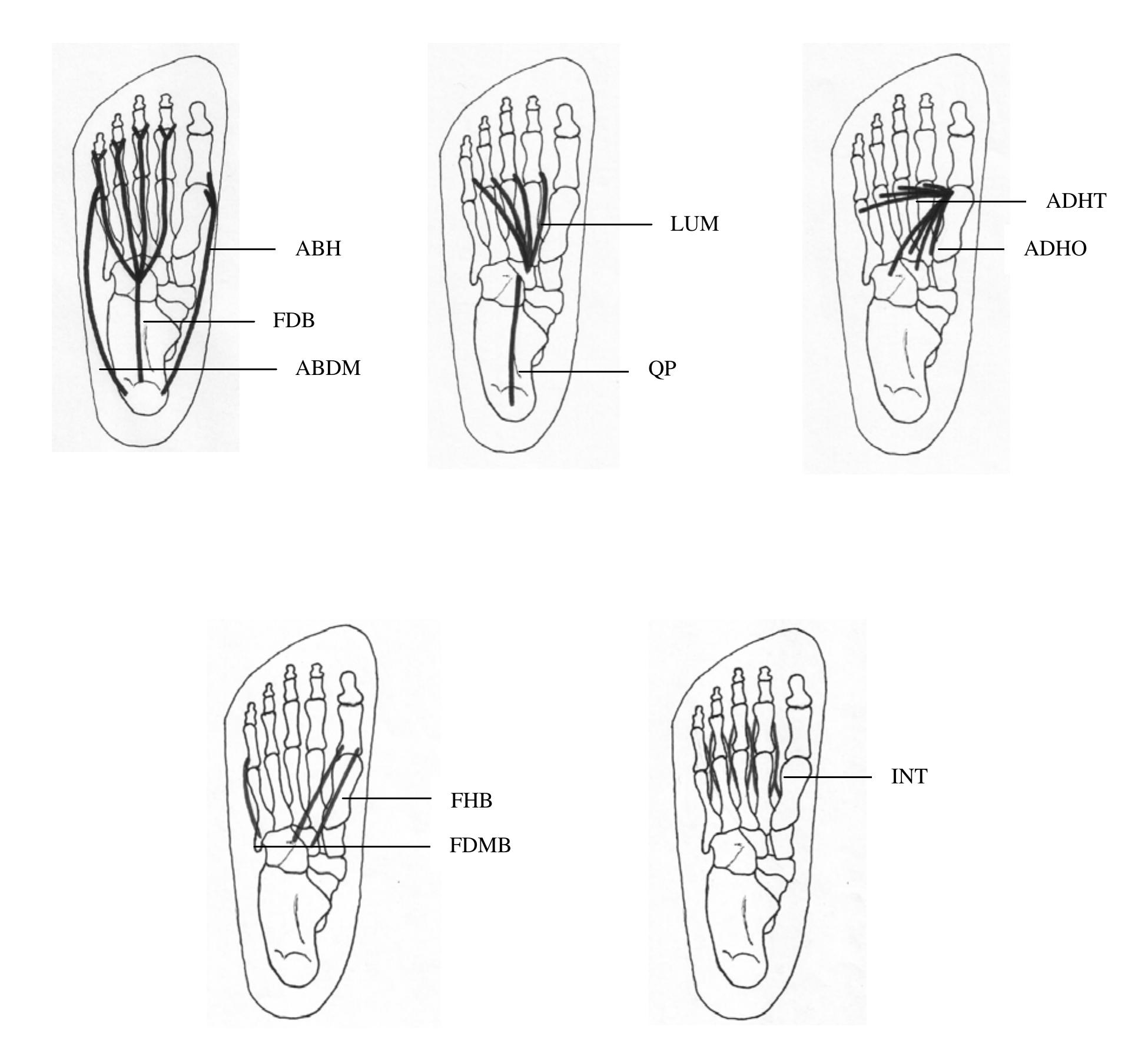 A diagrammatic representation of the intrinsic muscles of