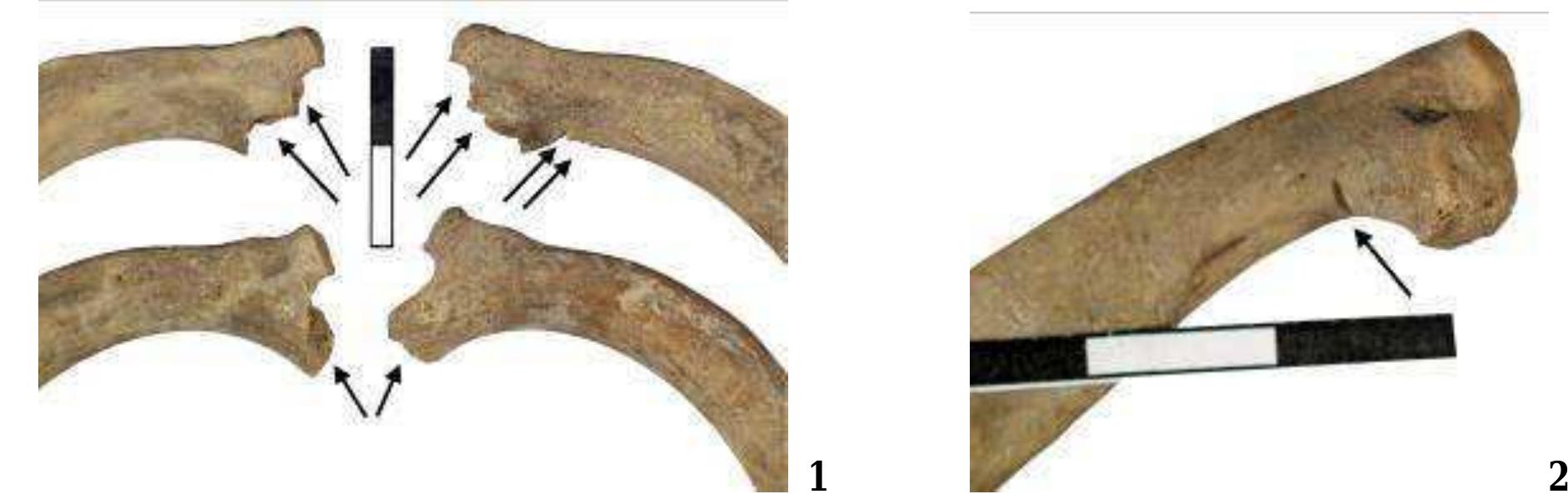 - human cut marks on ribs 4 and 5 | (left) and rib 1