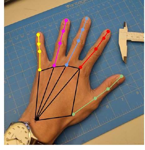 Hand measurements for a prosthetic arm, the size