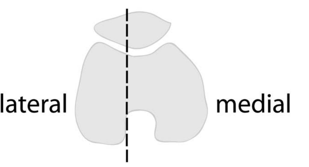 Defining anterior-lateral femoral region. the medial border