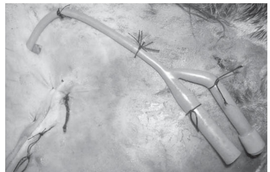 Foley’s catheter sutured at multiple sites on the ventral