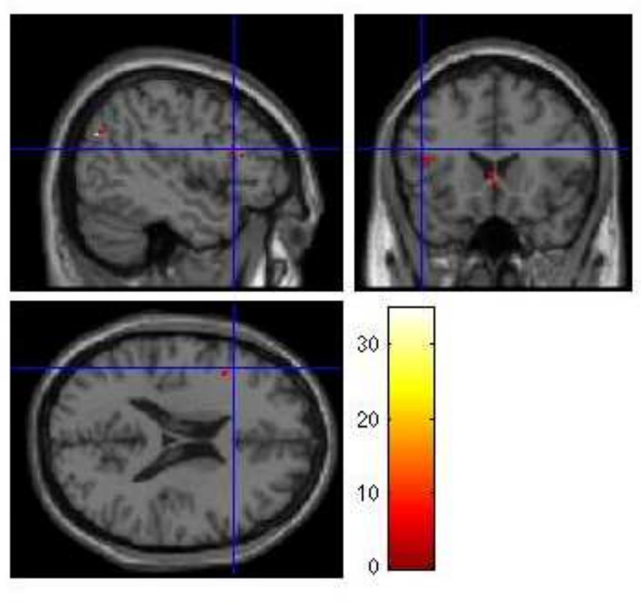 Figure 62 - Testing Applicability of Eye-Tracking and fMRI