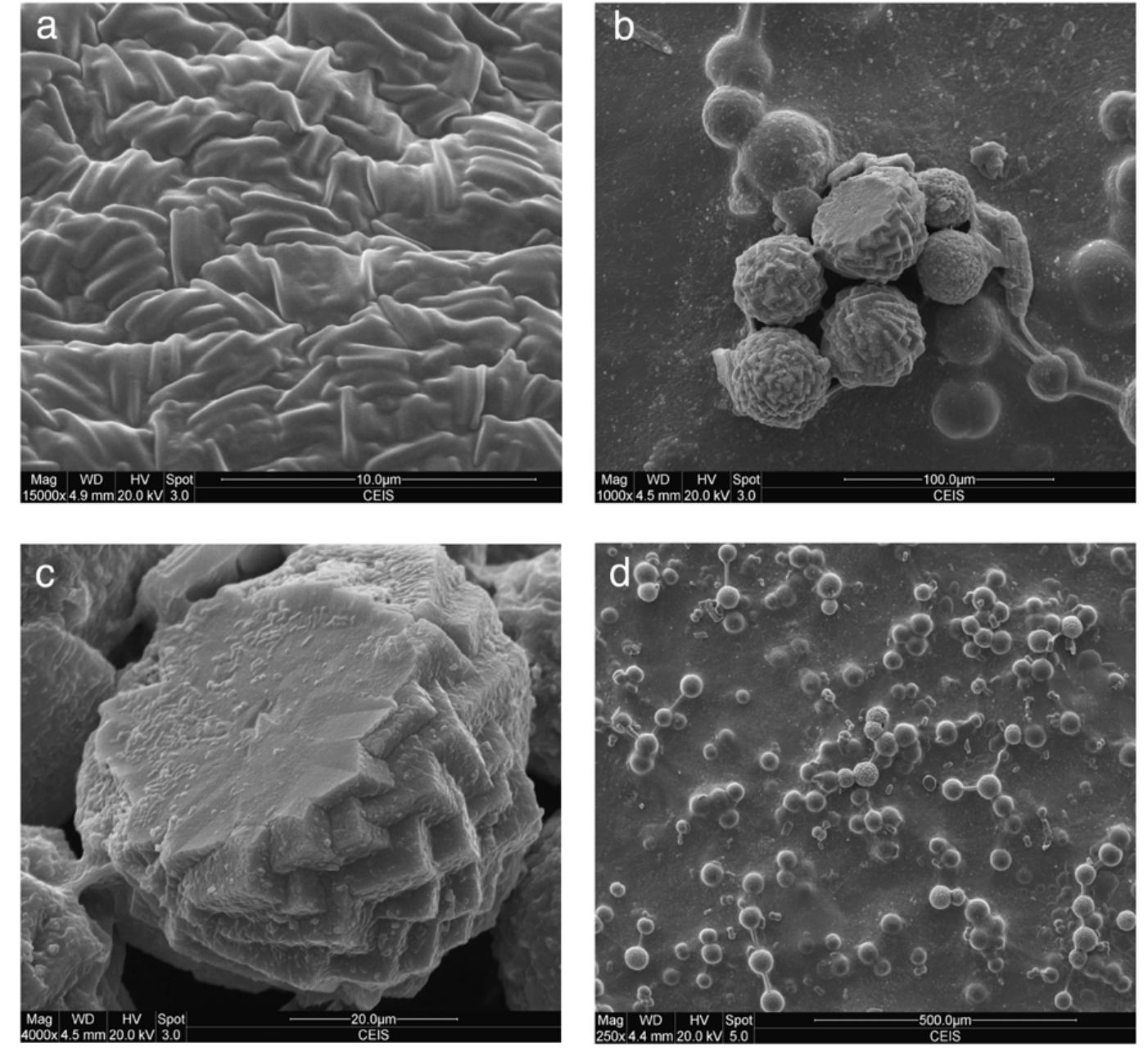 Electron microscope images of bacillus pasteurii growing in
