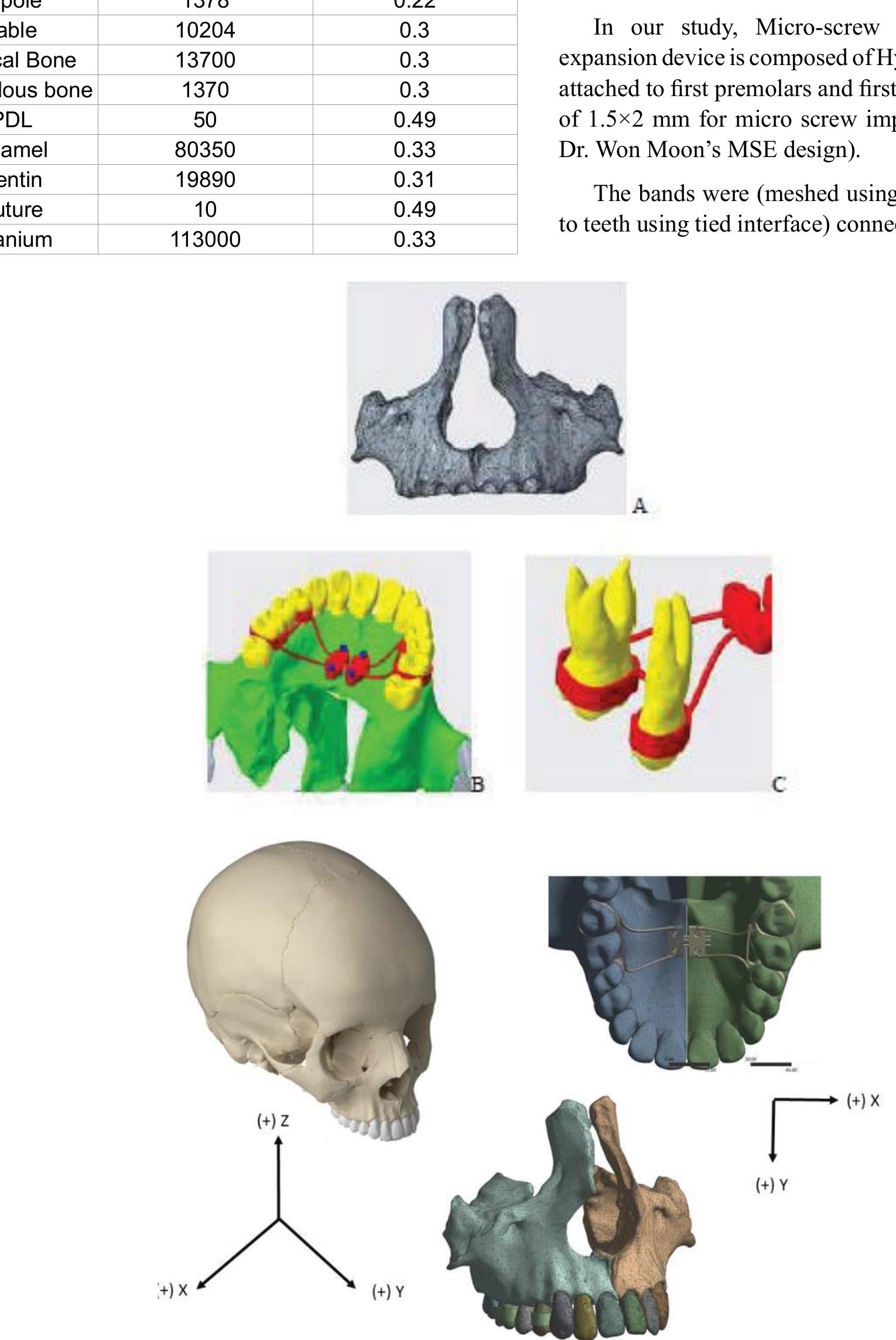 Schematic representation of the fe meshed model with 3d
