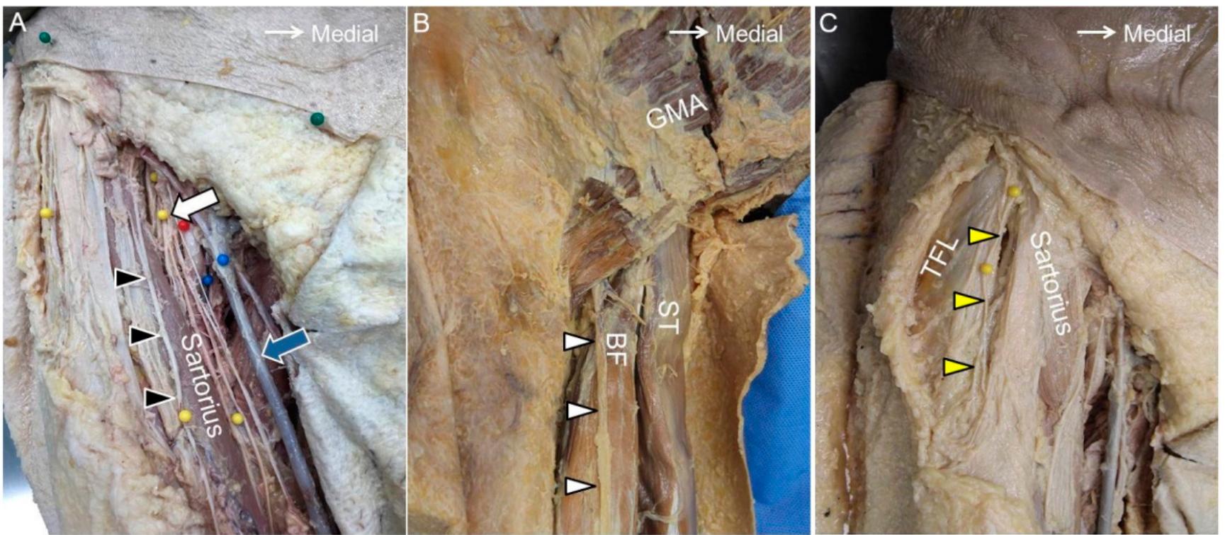 The anterior femoral cutaneous nerve (black arrowhead) at