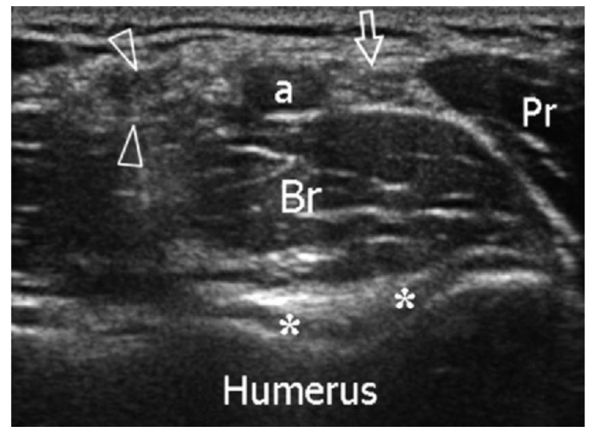 For examination of the anterior elbow, the patient is seated