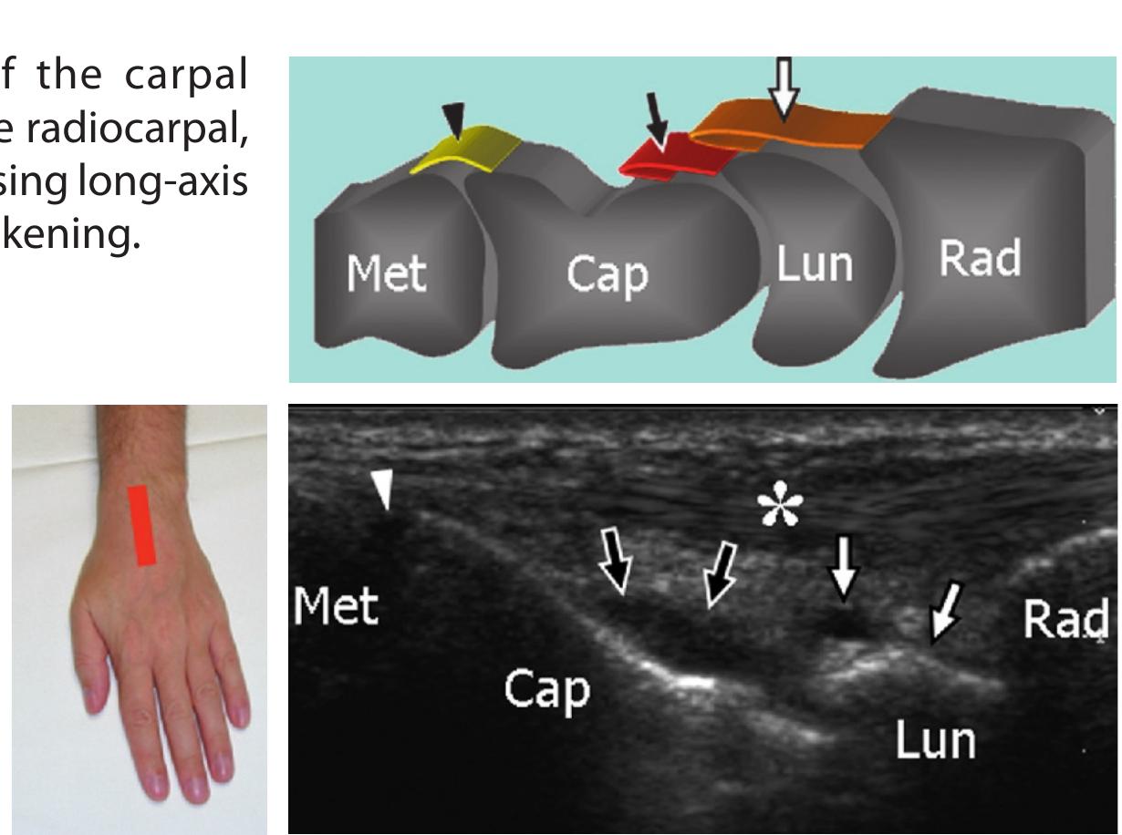 10. radiocarpal and midcarpal joints 117. ventral wrist:
