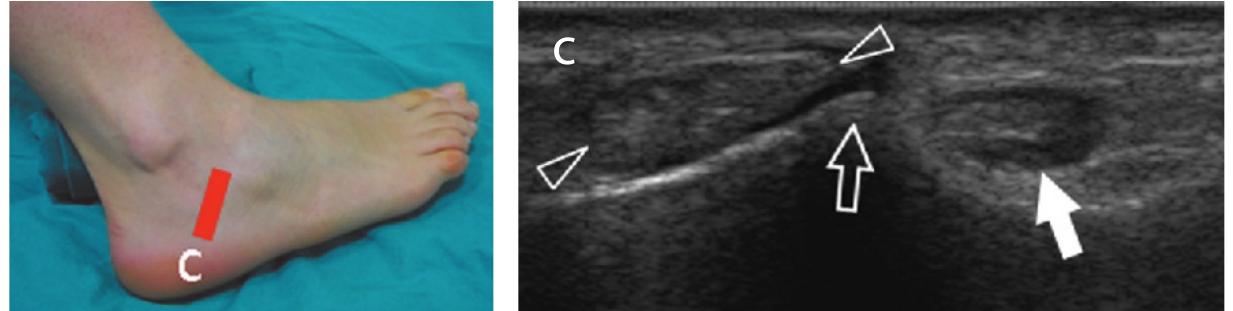 (PDF) Musculoskeletal ultrasound: technical guidelines