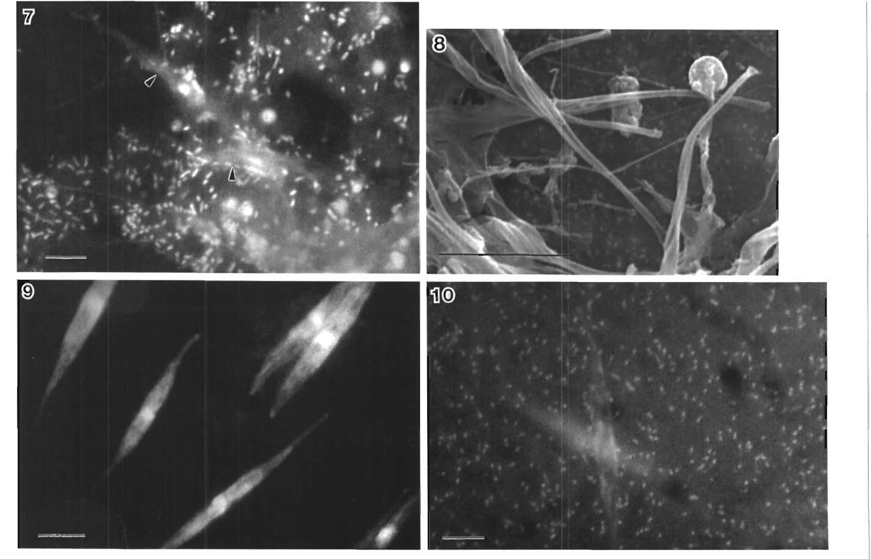 Figure 4 - Microbial aggregation and degradation of