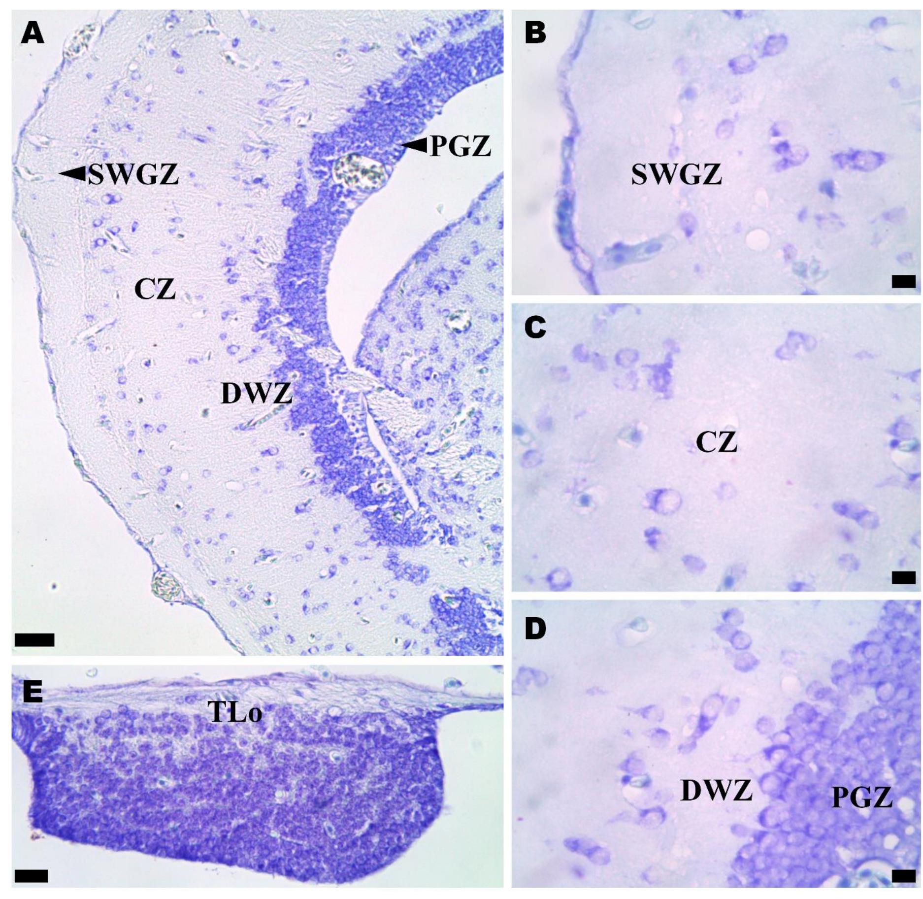 Photomicrographs of transverse sections of the catfish brain