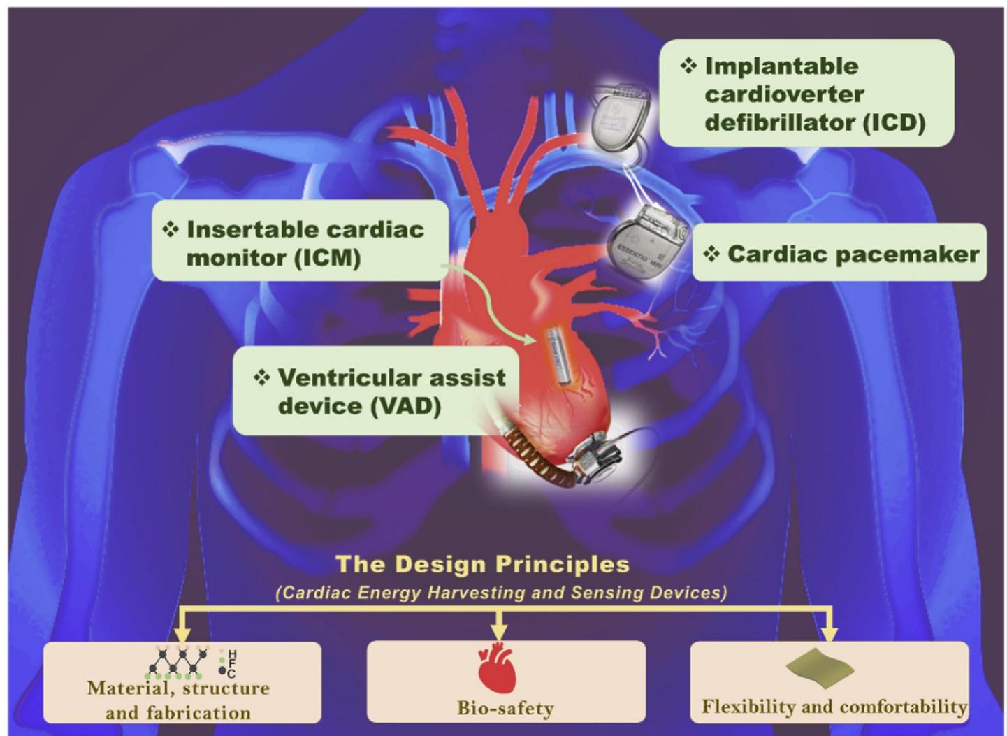 Typical cardiac implantable electronic devices and a