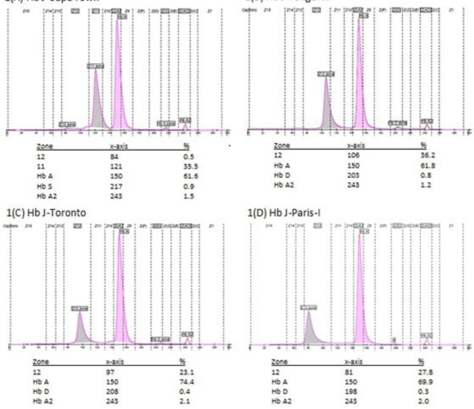 Capillary zone chromatogram migration patterns, zone,