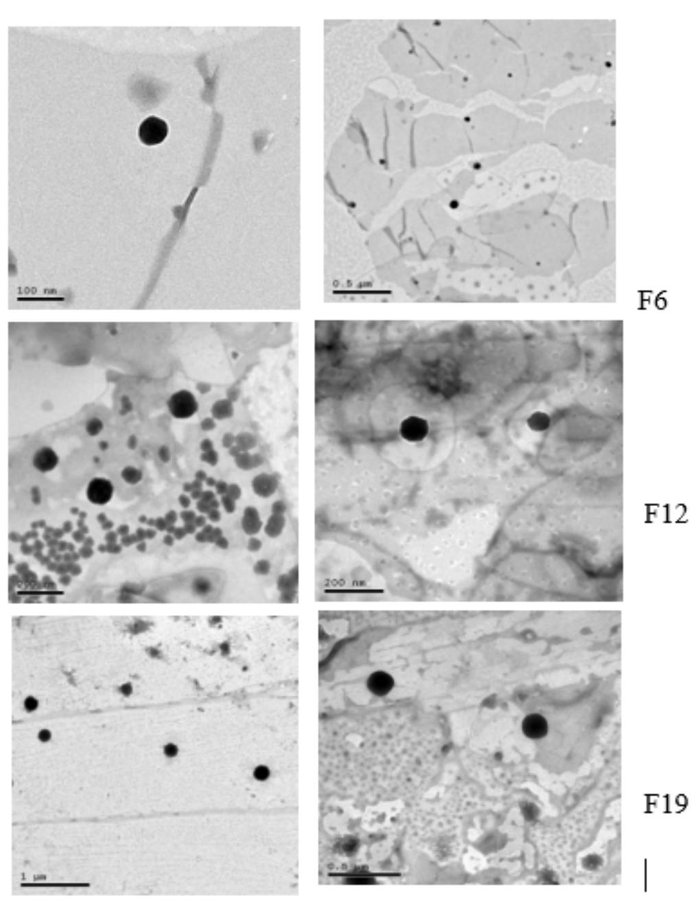 Transmission electron microscope photographs of the selected