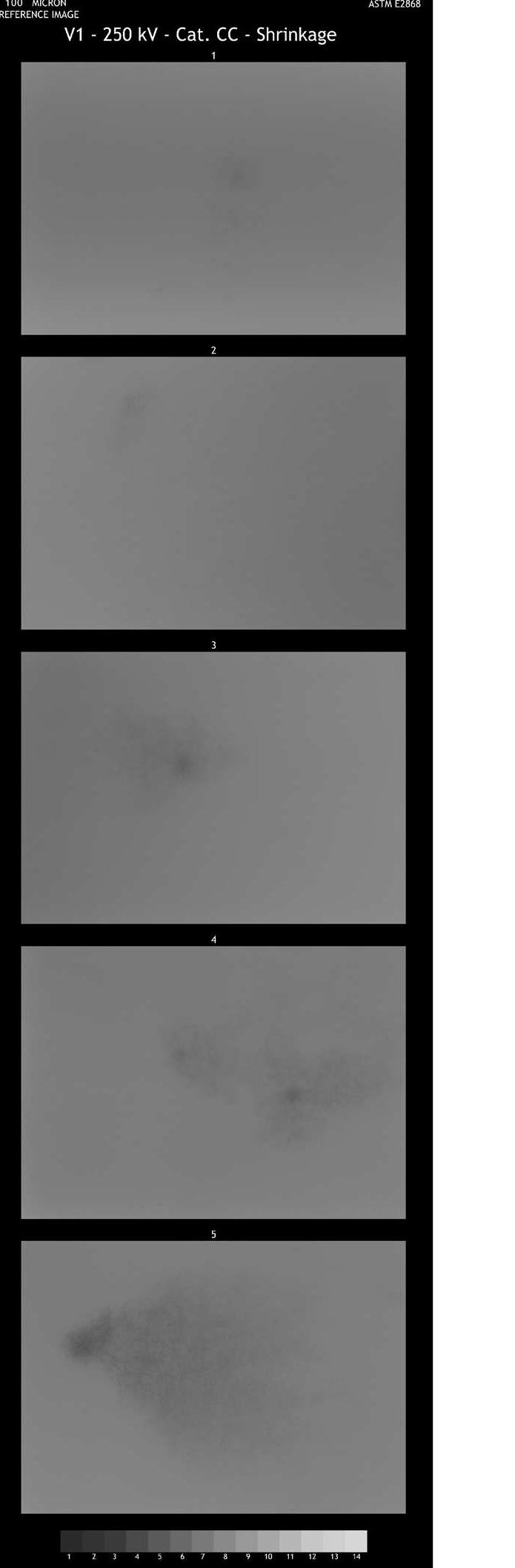 Figure 16 - Shrinkage Porosity in Steel Sand Castings: