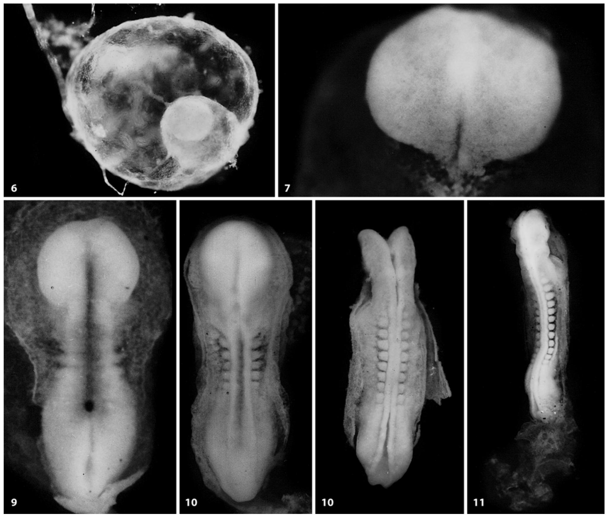 1 dorsal views of staged early human embryos (carnegie