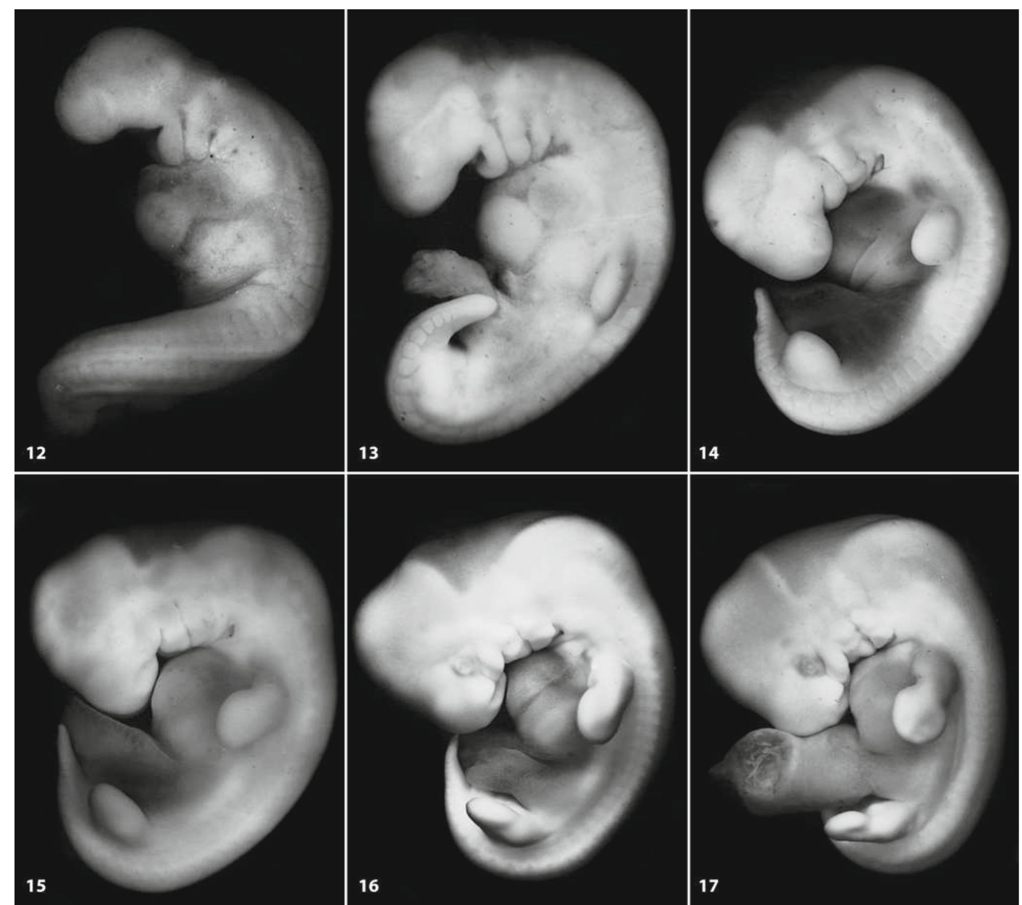 2 lateral views of staged human embryos (carnegie stages