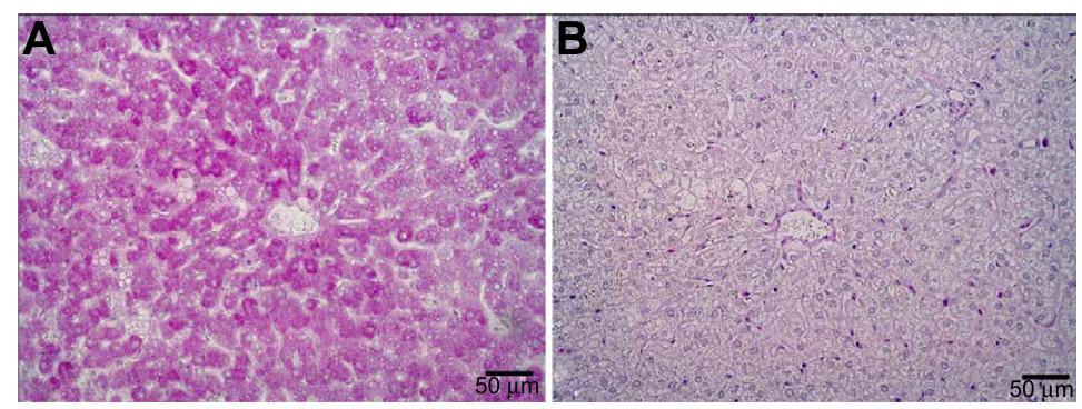 Periodic acid—schiff staining of diastase pretreated