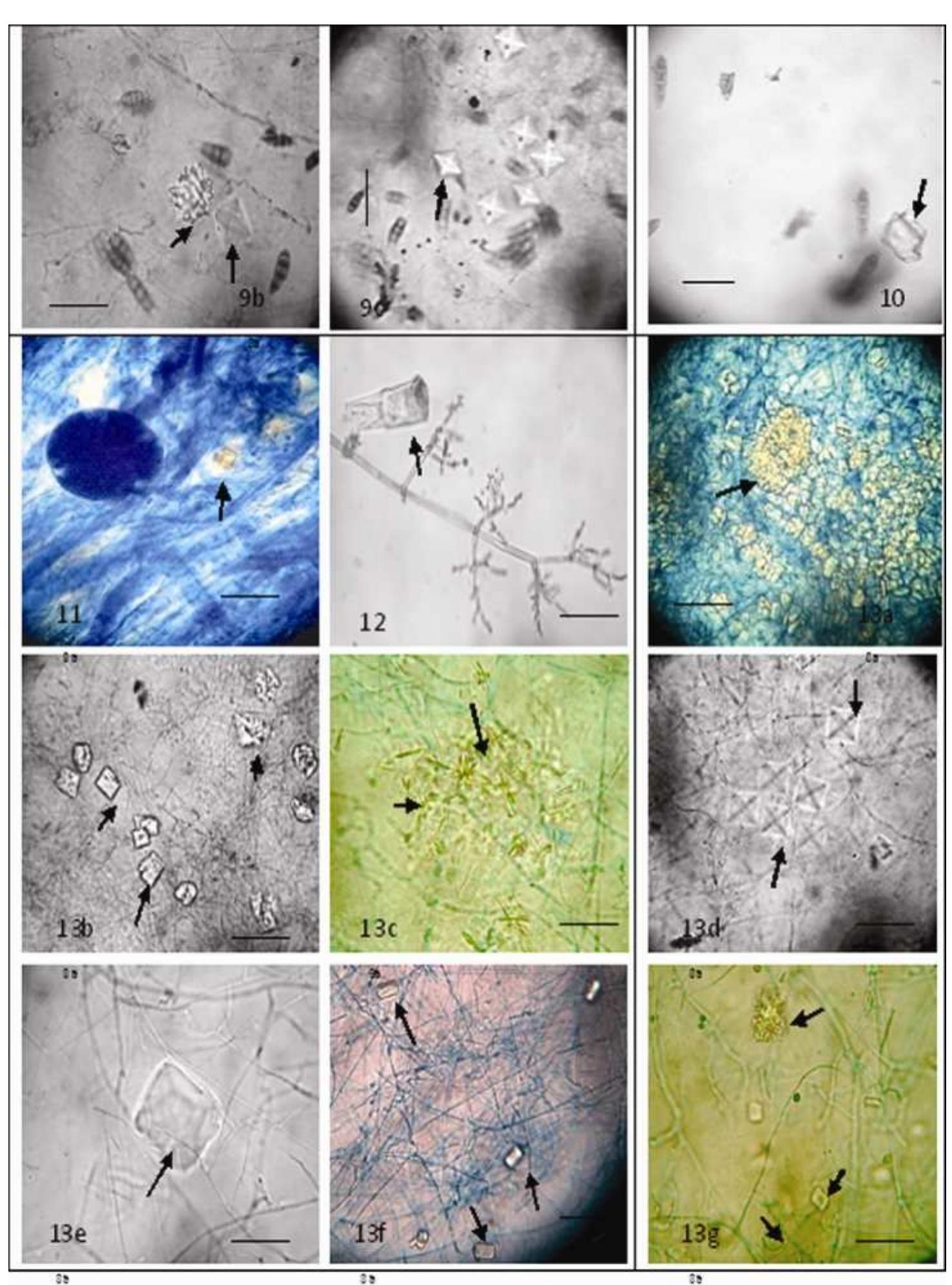 Figure 3 - Crystal Formation In Cultures Of Fungi : New
