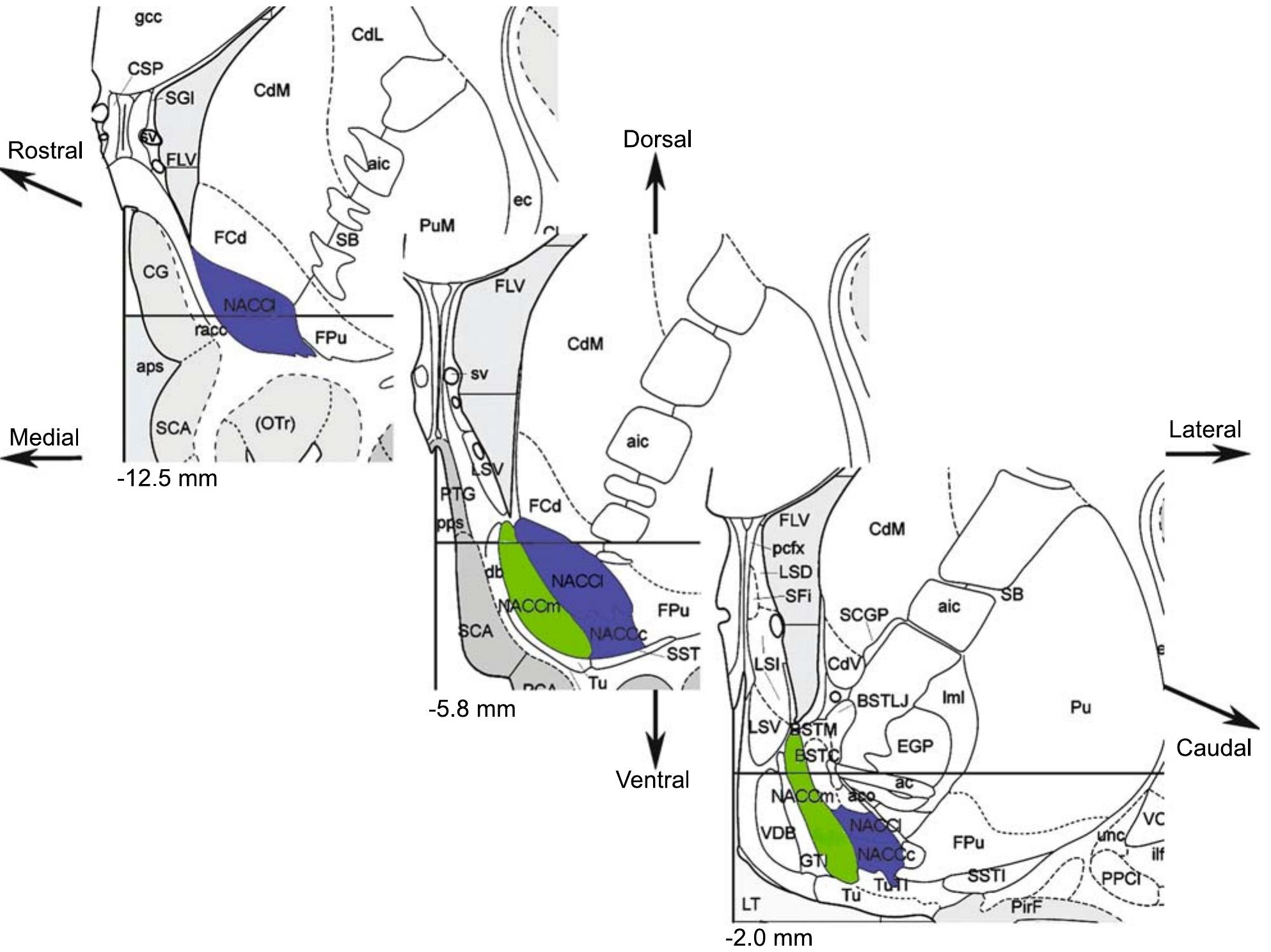 Nacc core and shell: graphical representation of coronal