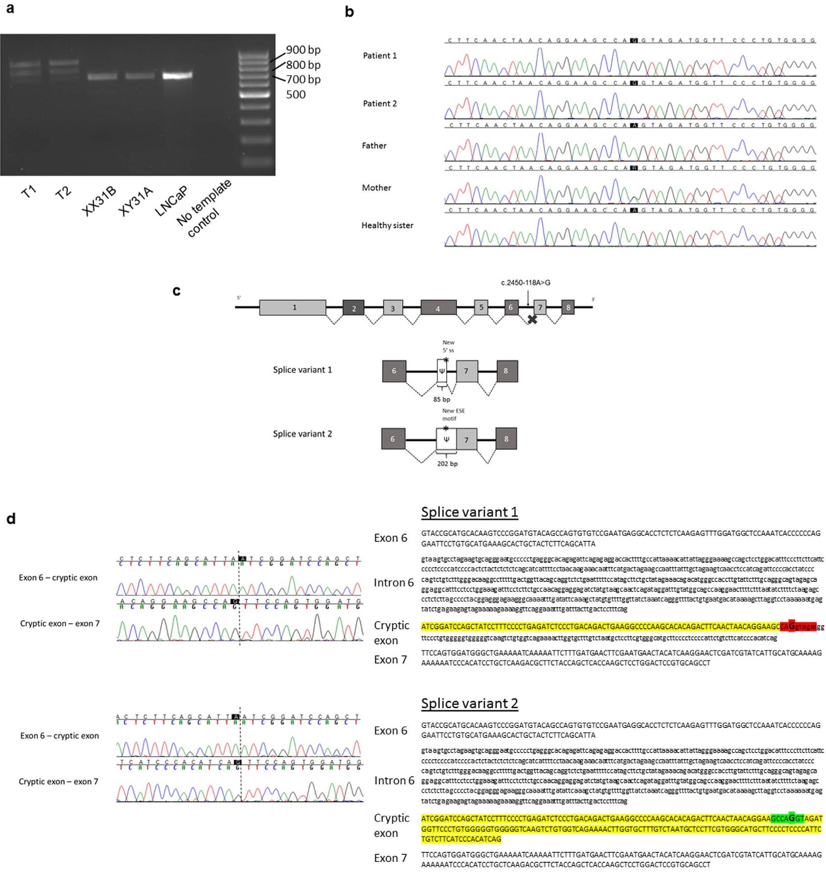The pcr amplification of ar cdna (a), the identified